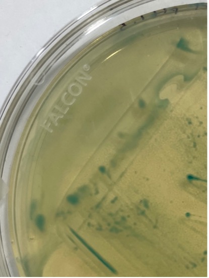 Impact of Hydrochloric Acid on Genetically Modified Escherichia coli ...