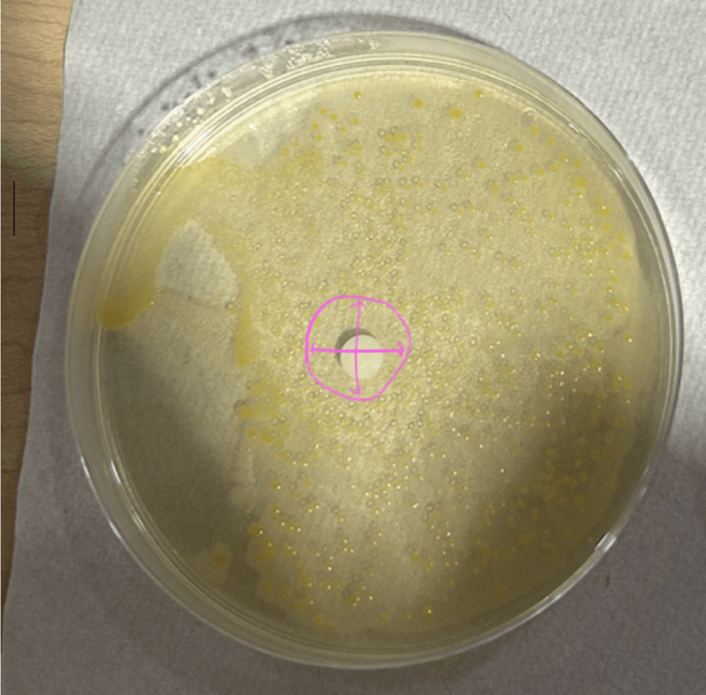 Effectiveness of Antibacterial Agents (Honey, Garlic Extract, Tea Tree ...